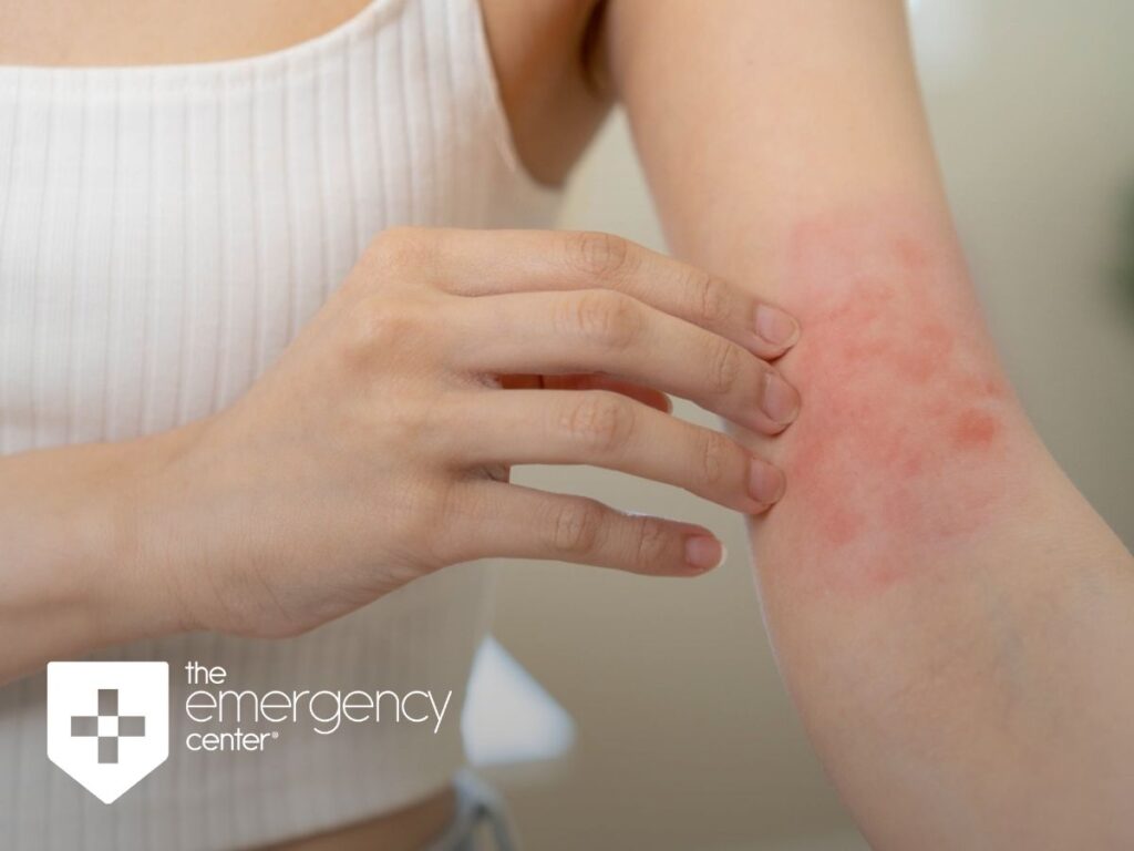 Understanding Different Types Of Skin Redness