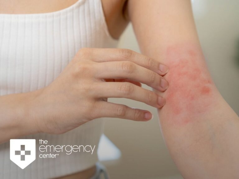 Understanding Different Types Of Skin Redness